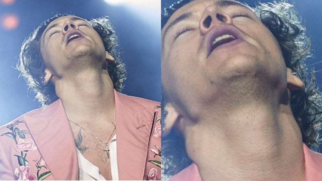 Harry Styles y el serio accidente que inspiró éxito de Taylor Swift ...