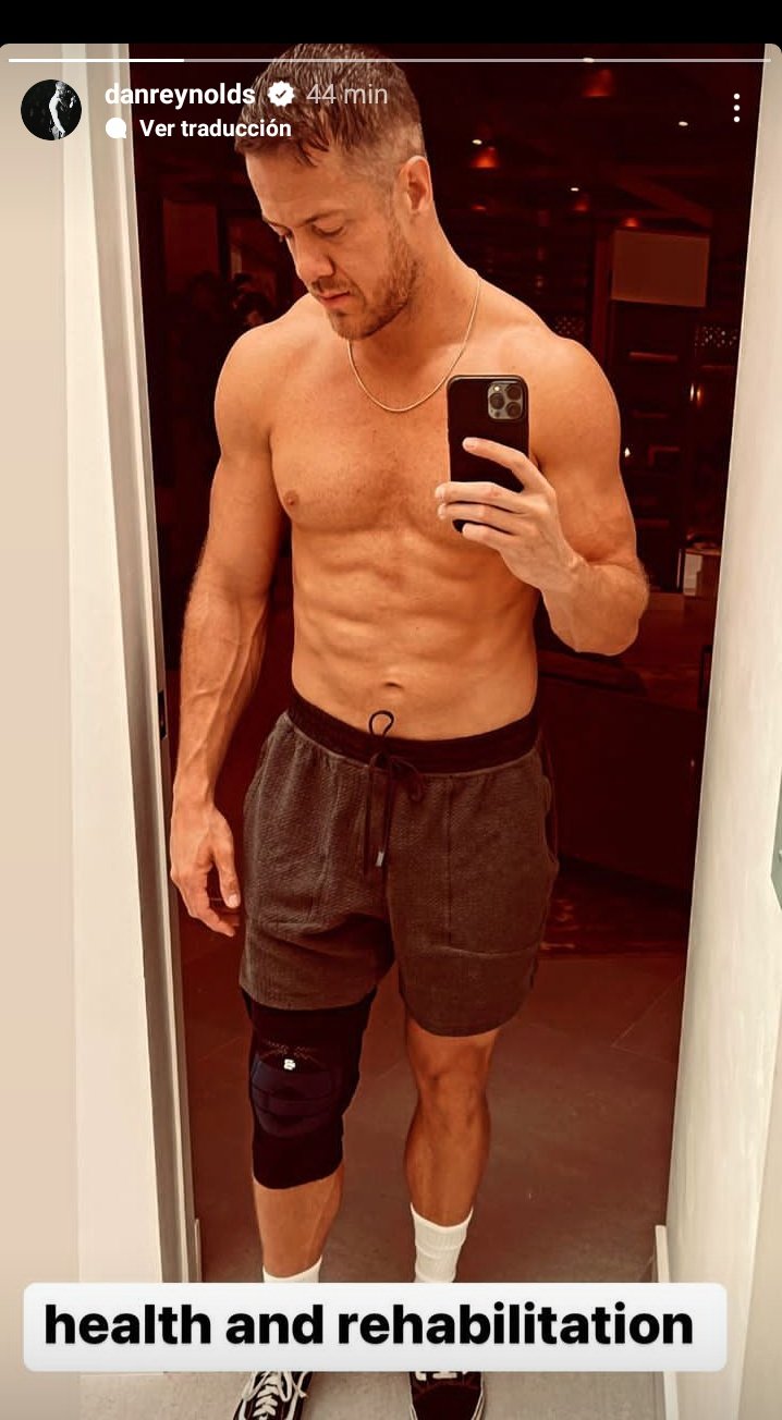 Imagine Dragons en Chile: Dan Reynolds muestra su lesión — Rock&Pop