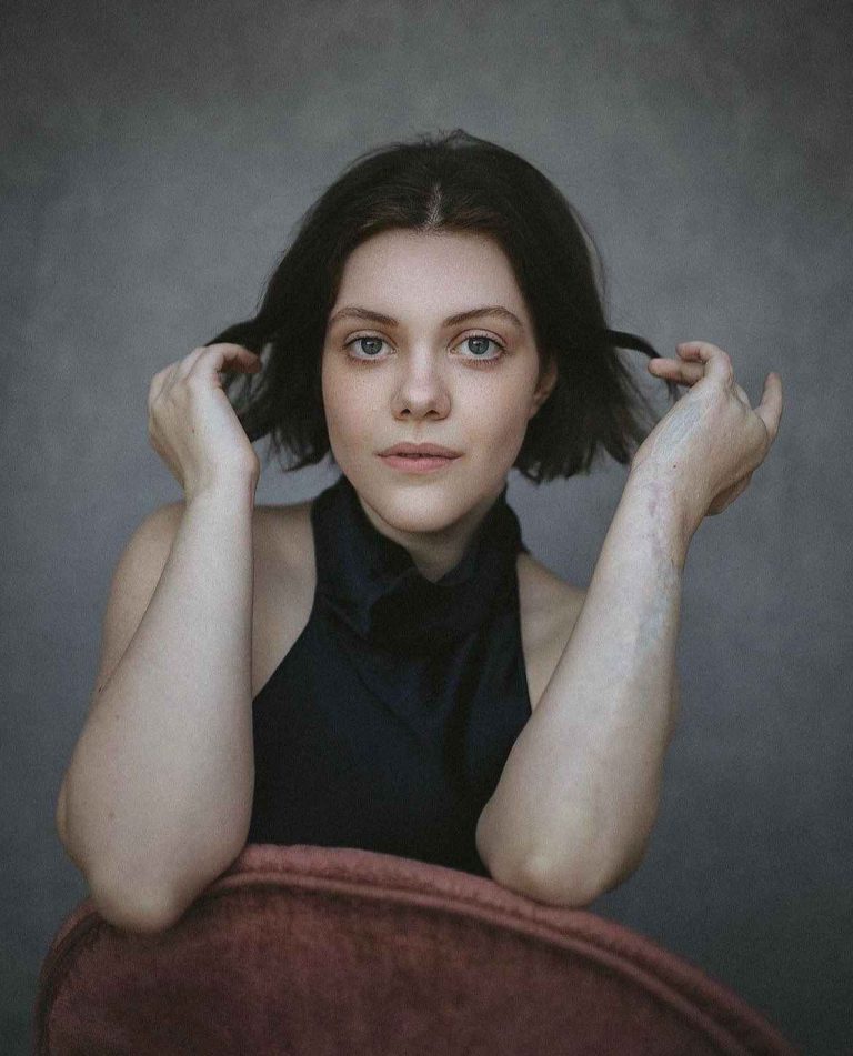 Georgie Henley de Las Crónicas de Narnia muestra raras cicatrices ...