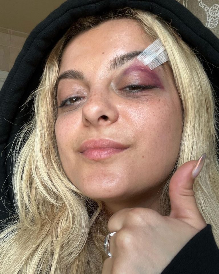 Bebe Rexha colapsó en escenario luego de que fan la golpeara con ...