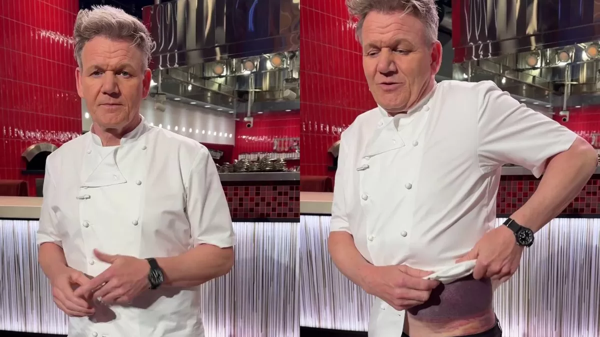 "Tengo suerte de estar aquí..." La impactante lesión de Gordon Ramsay ...